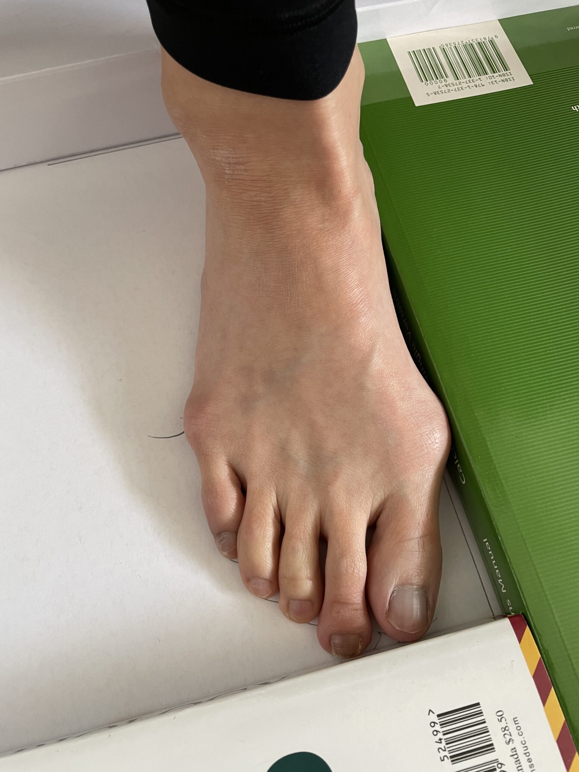 KYAKUSHIN SPEED – kyakushin